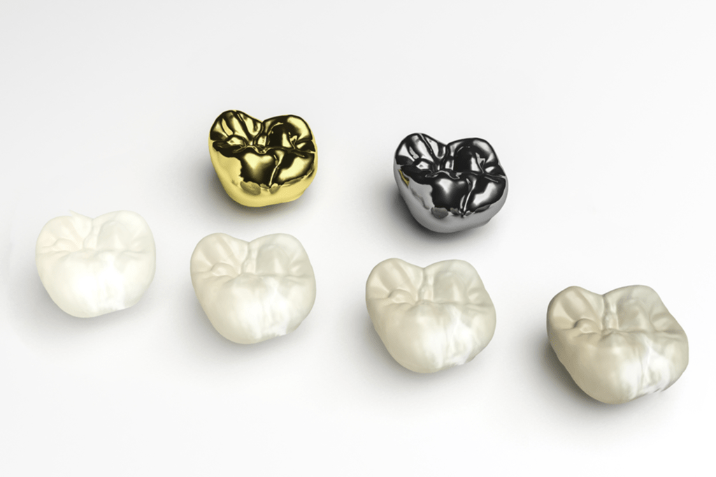 All You Need to Know About Dental Crowns